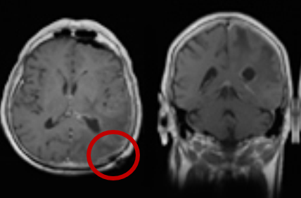 Access - NICO Corporation