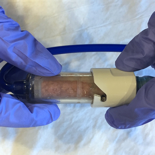 Brain Biopsy - NICO Corporation