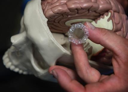 Spectrum Health uses NICO technology for minimally invasive removal of ...