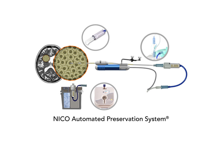 NICO Awards $180,000 Grant to Study GBM Progression Using Novel ...