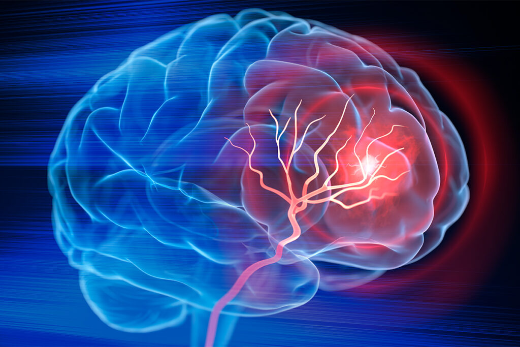 ENRICH study leads to first positive surgical trial in the deadliest ...
